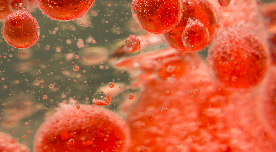 UWA hosts WHO expert working group for implementation of Patient Blood ...