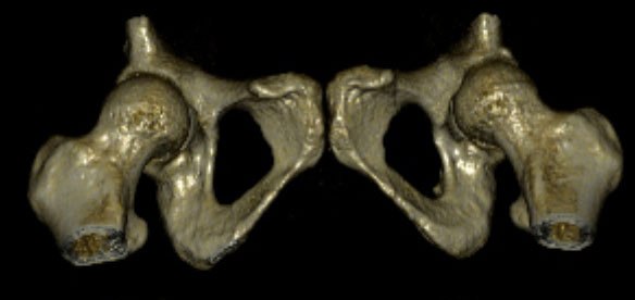 Centre For Forensic Anthropology The University Of Western Australia